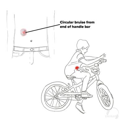 EM:RAP | CorePendium